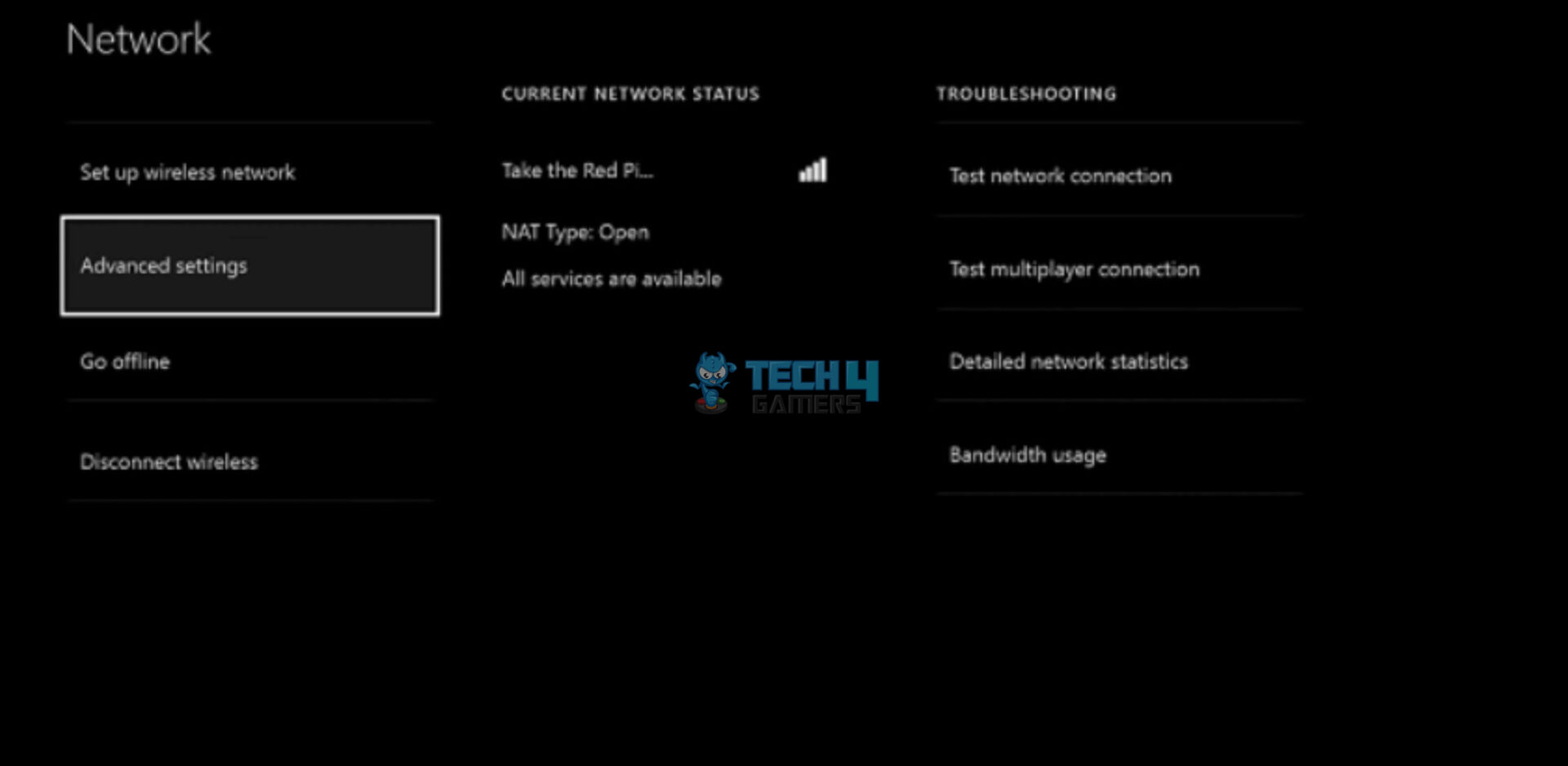 DNS Isn’t Resolving Xbox Server Names [Our Quick Fixes] - Tech4Gamers