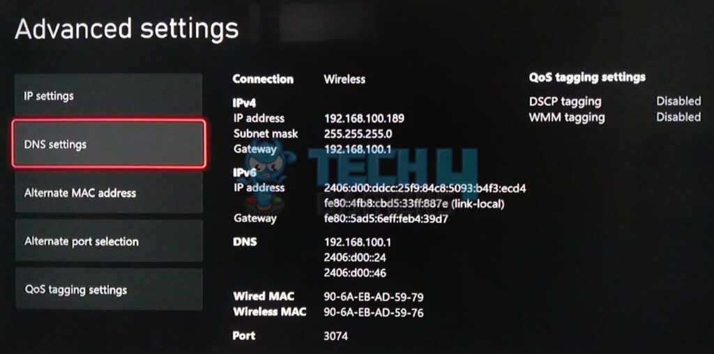Xbox Series X Won't Connect To Wi-Fi [20 FIXES] - Tech4Gamers